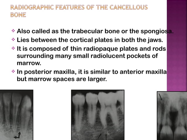 NORMAL ANATOMIC LANDMARKS ; PRICHARDS CRITERIA ; NORMAL INTERDENTAL ...