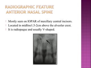 NORMAL ANATOMIC LANDMARKS ; PRICHARDS CRITERIA ; NORMAL INTERDENTAL ...