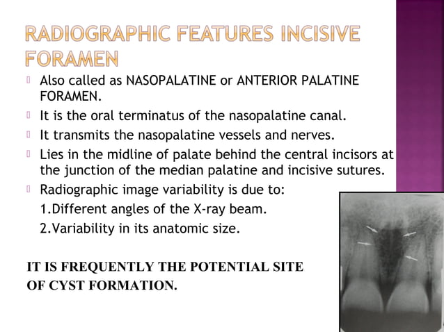NORMAL ANATOMIC LANDMARKS ; PRICHARDS CRITERIA ; NORMAL INTERDENTAL ...