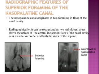 NORMAL ANATOMIC LANDMARKS ; PRICHARDS CRITERIA ; NORMAL INTERDENTAL ...