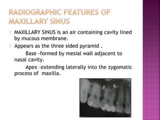 NORMAL ANATOMIC LANDMARKS ; PRICHARDS CRITERIA ; NORMAL INTERDENTAL ...