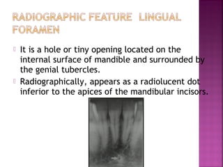 NORMAL ANATOMIC LANDMARKS ; PRICHARDS CRITERIA ; NORMAL INTERDENTAL ...
