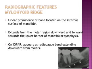NORMAL ANATOMIC LANDMARKS ; PRICHARDS CRITERIA ; NORMAL INTERDENTAL ...