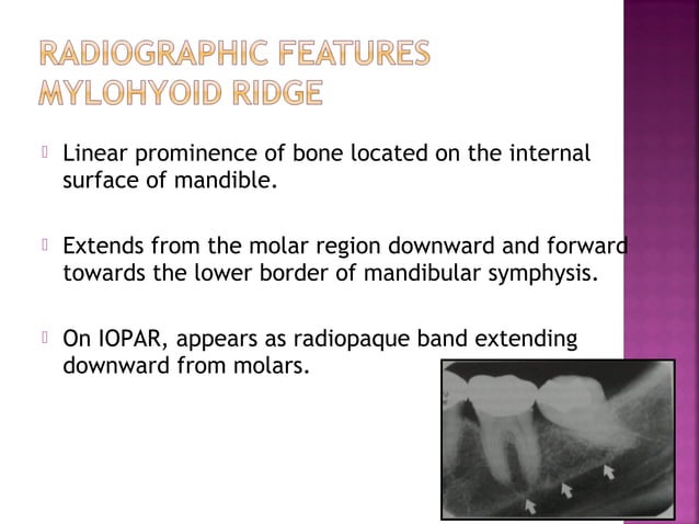 NORMAL ANATOMIC LANDMARKS ; PRICHARDS CRITERIA ; NORMAL INTERDENTAL ...