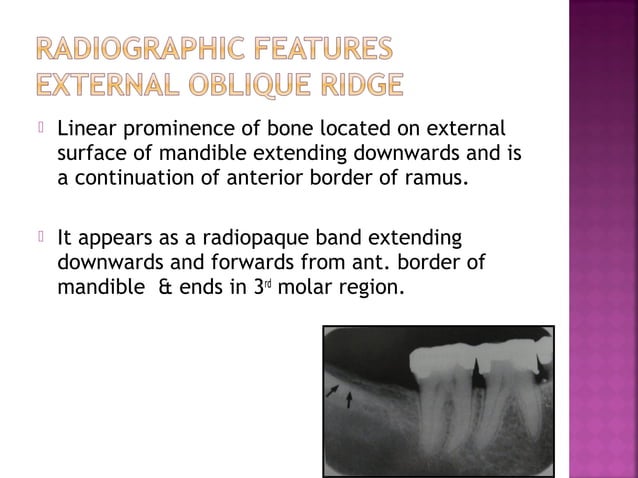 NORMAL ANATOMIC LANDMARKS ; PRICHARDS CRITERIA ; NORMAL INTERDENTAL ...