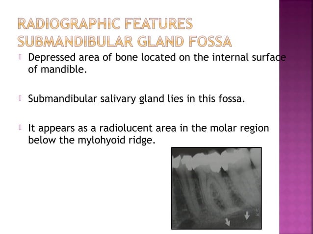 NORMAL ANATOMIC LANDMARKS ; PRICHARDS CRITERIA ; NORMAL INTERDENTAL ...