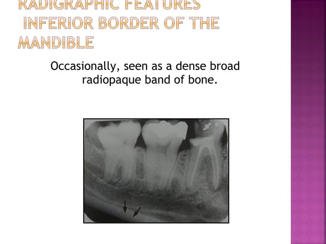 NORMAL ANATOMIC LANDMARKS ; PRICHARDS CRITERIA ; NORMAL INTERDENTAL ...