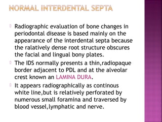 NORMAL ANATOMIC LANDMARKS ; PRICHARDS CRITERIA ; NORMAL INTERDENTAL ...