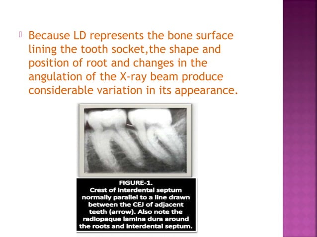NORMAL ANATOMIC LANDMARKS ; PRICHARDS CRITERIA ; NORMAL INTERDENTAL ...