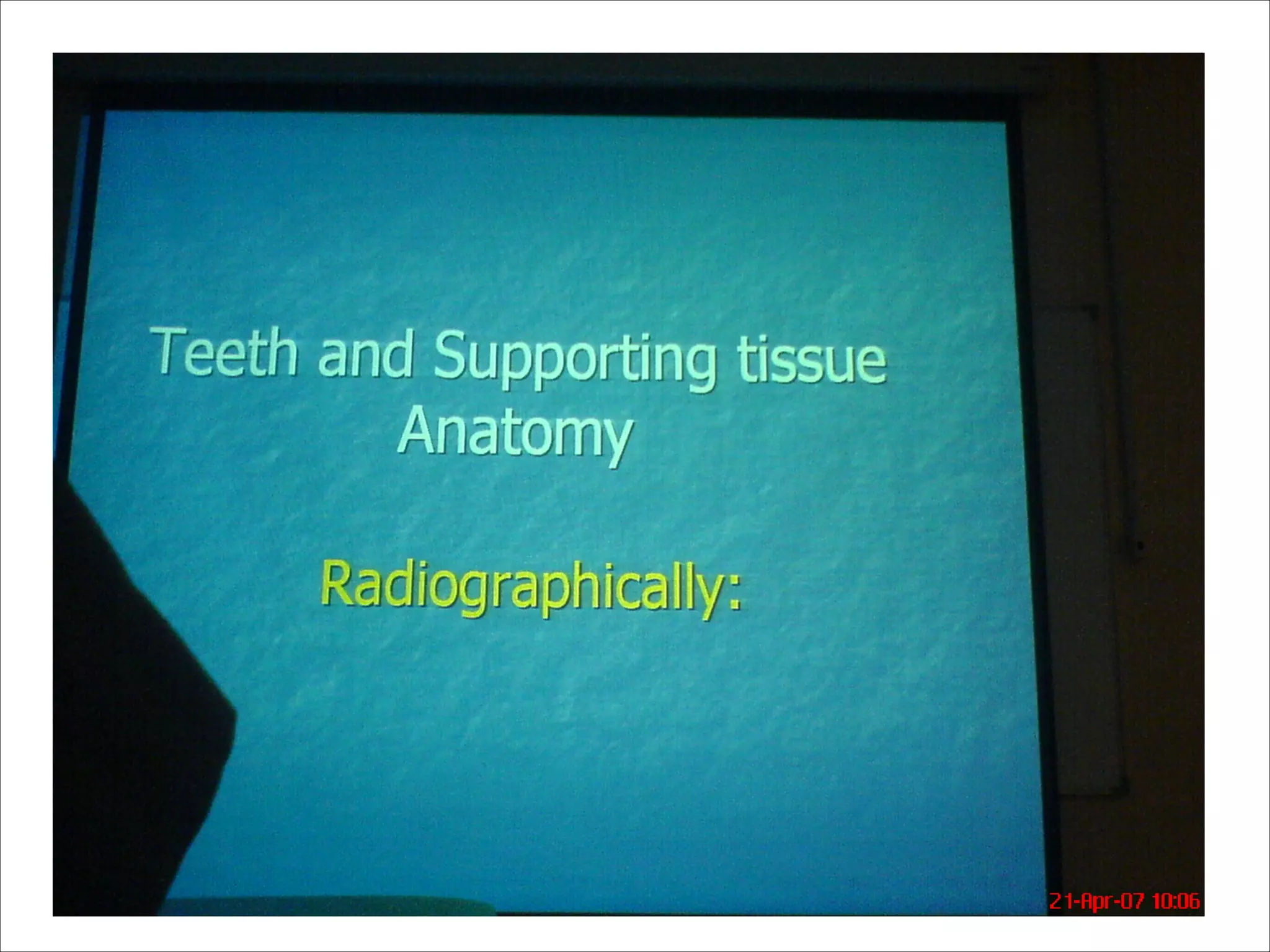 Normal Radiographic Anatomy | PDF | Medical Tests | Medical Health