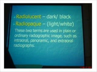 Normal Radiographic Anatomy | PPT