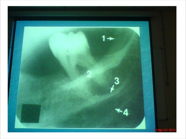 Normal Radiographic Anatomy | PDF