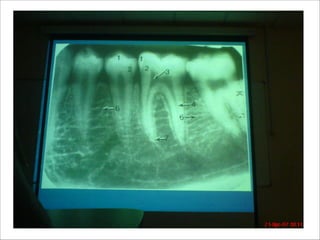 Normal Radiographic Anatomy | PPT