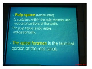 Normal Radiographic Anatomy | PPT