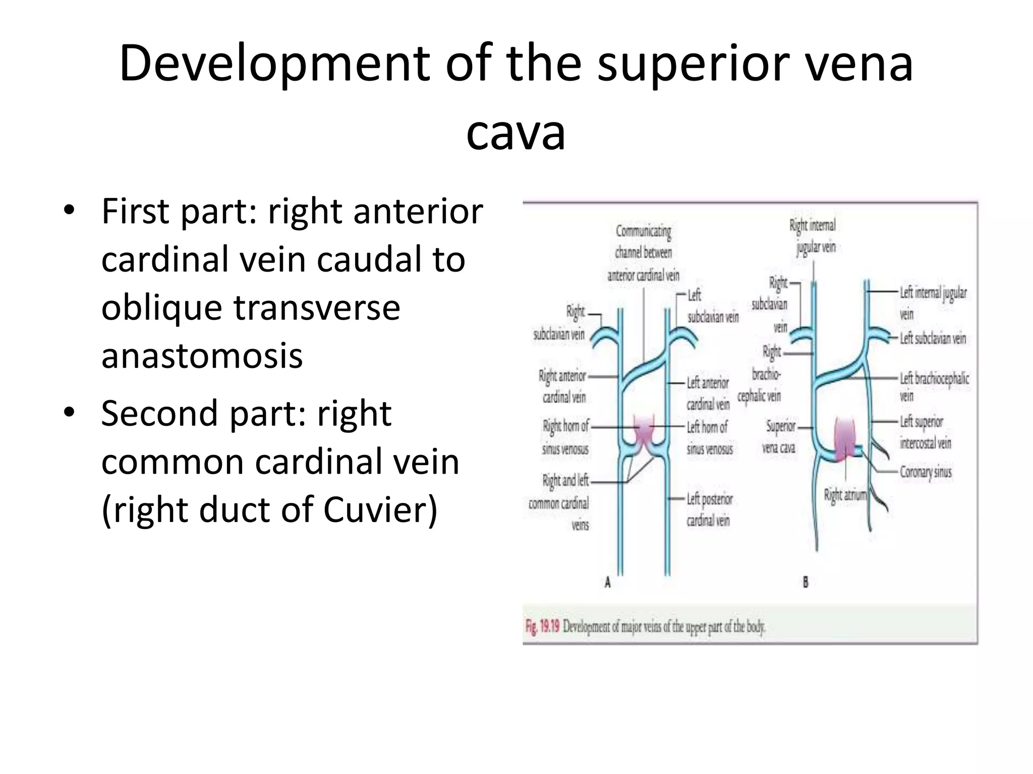 Normal anatomy and congenital anomalies of vena cavae | PPTX