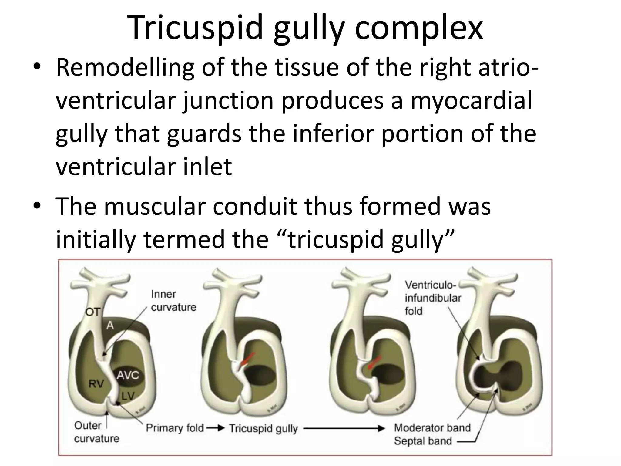 Normal anatomy of tricuspid valve | PPTX