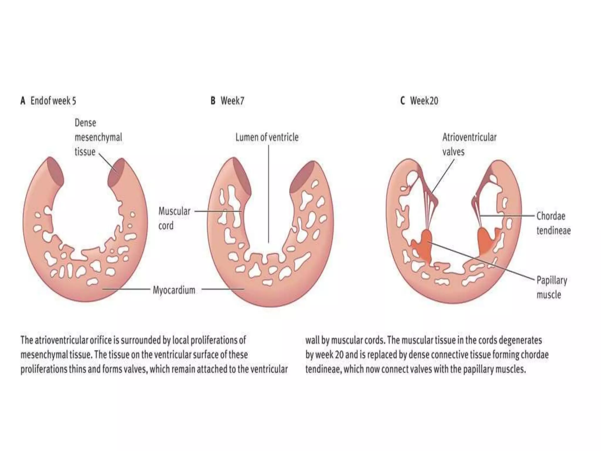 Normal anatomy of tricuspid valve | PPTX