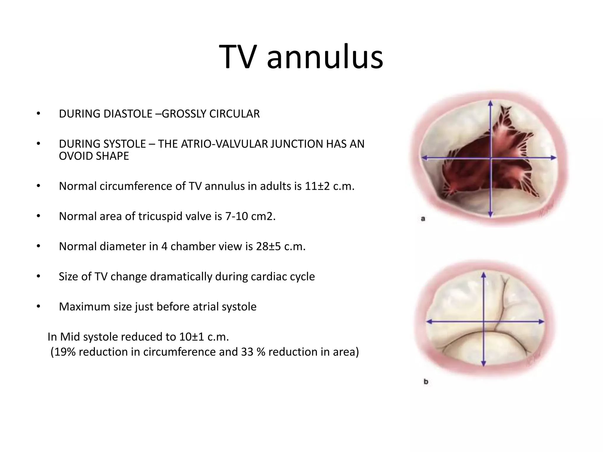 Normal anatomy of tricuspid valve | PPTX