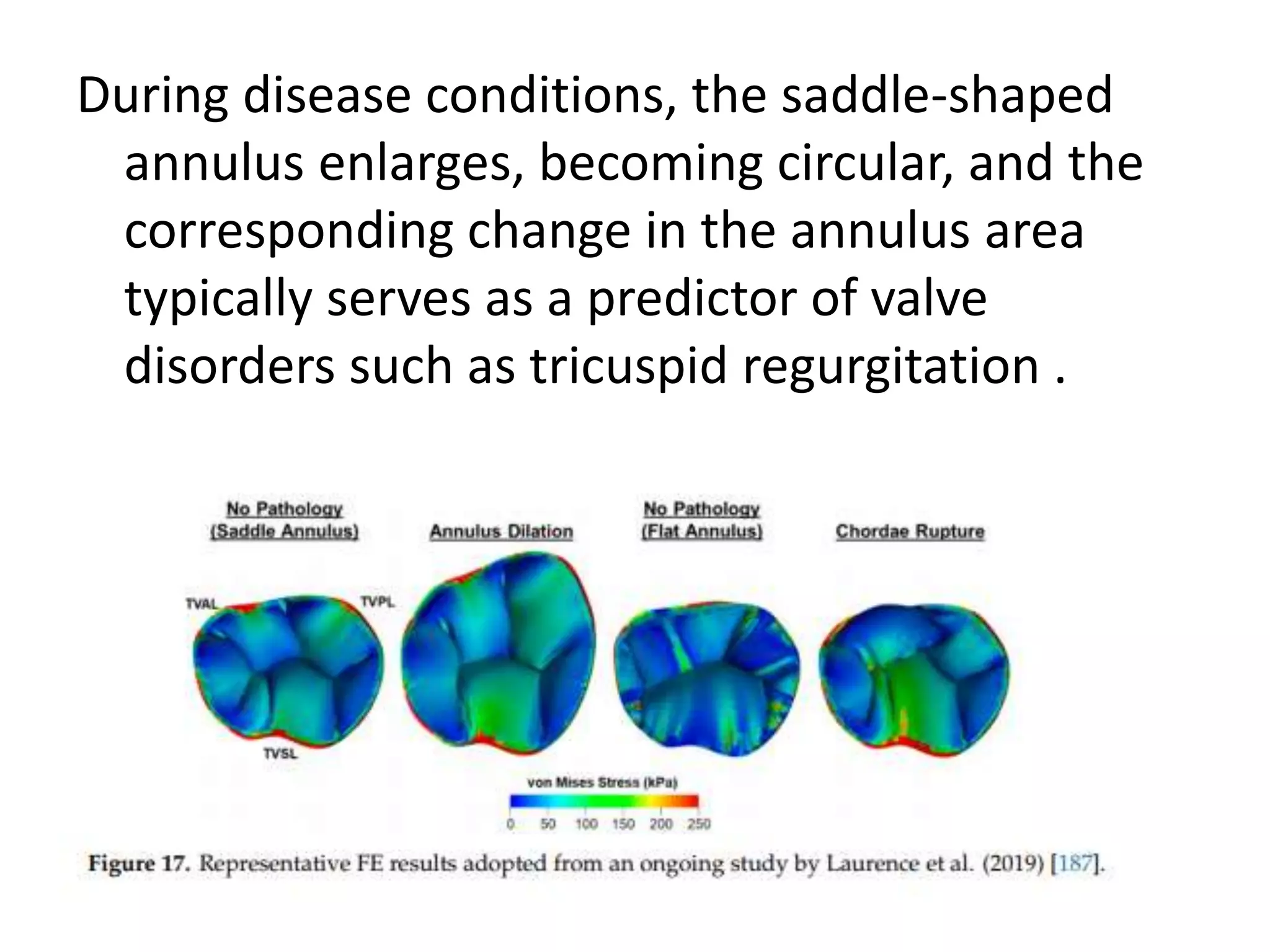 Normal anatomy of tricuspid valve | PPTX