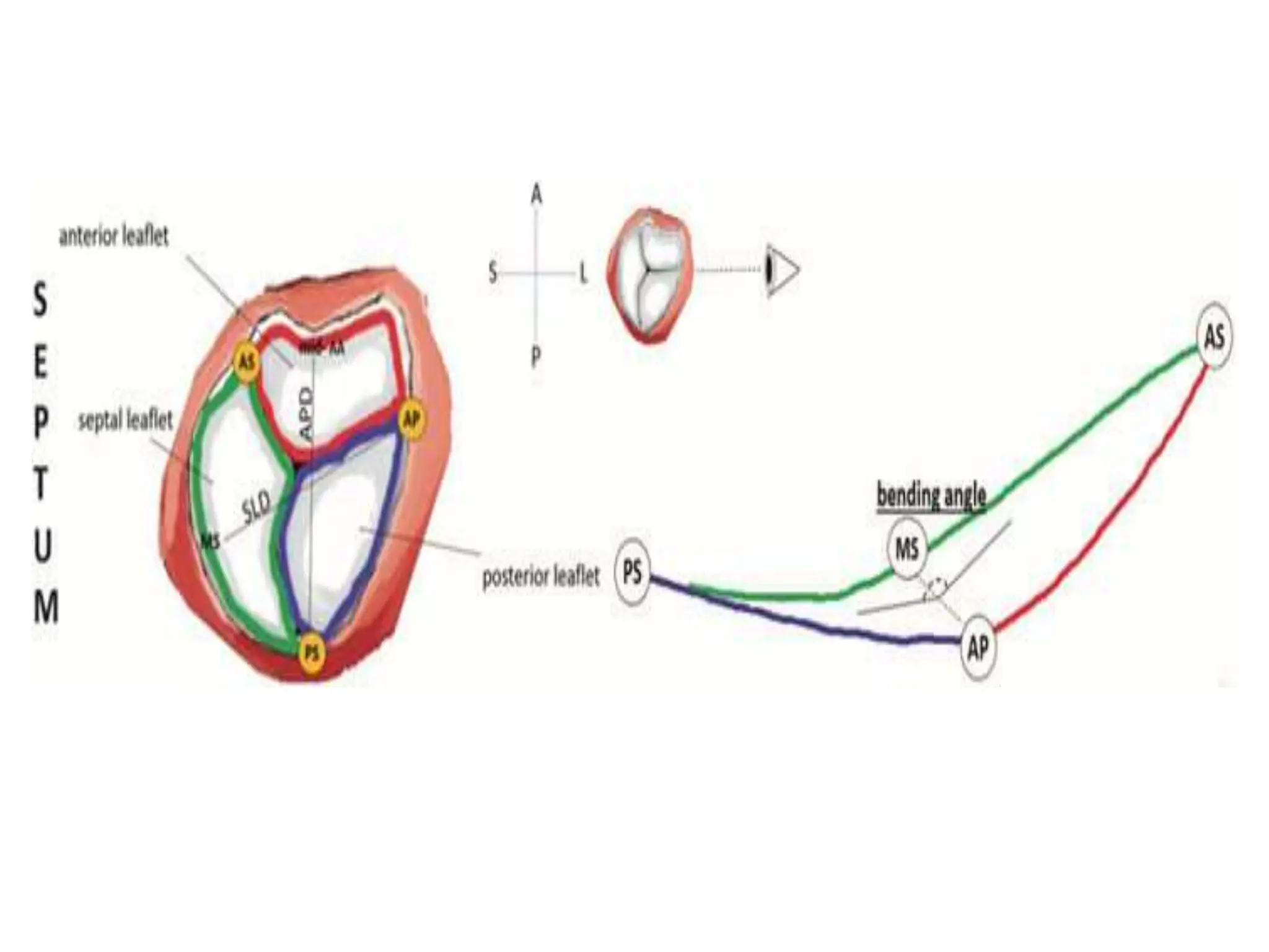 Normal anatomy of tricuspid valve | PPTX