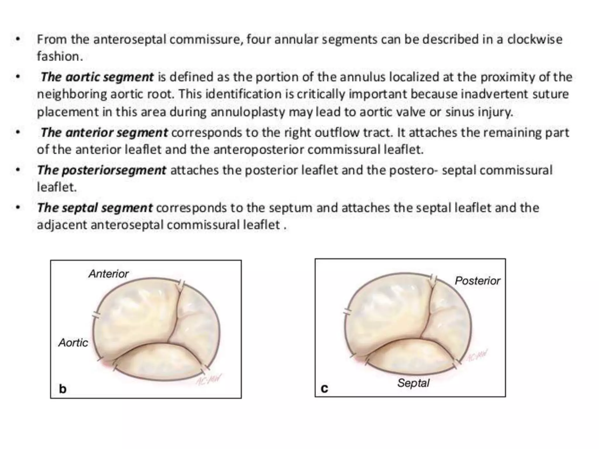 Normal anatomy of tricuspid valve | PPTX