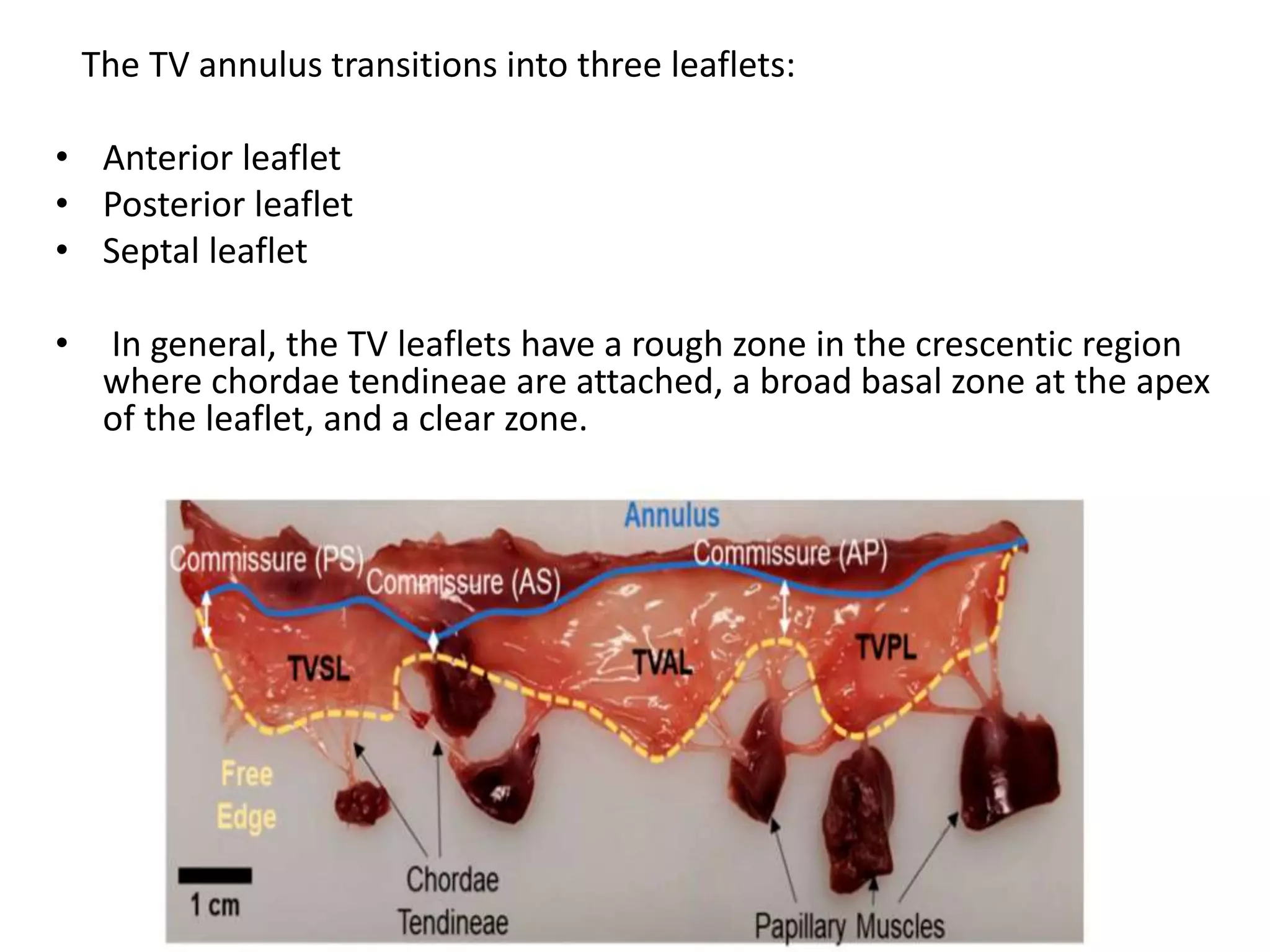 Normal anatomy of tricuspid valve | PPTX
