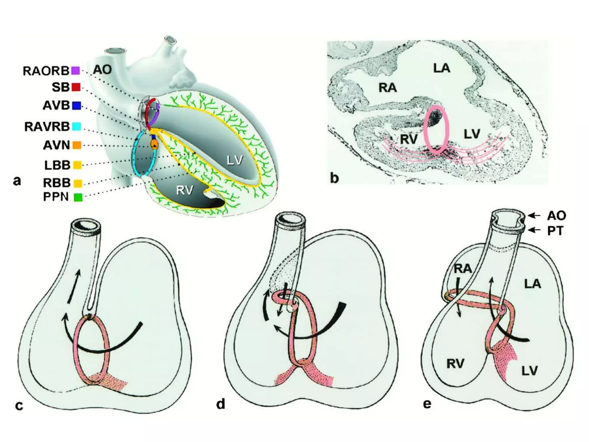 Normal anatomy of tricuspid valve | PPTX
