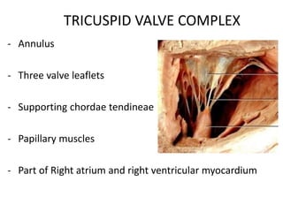 Normal anatomy of tricuspid valve | PPTX