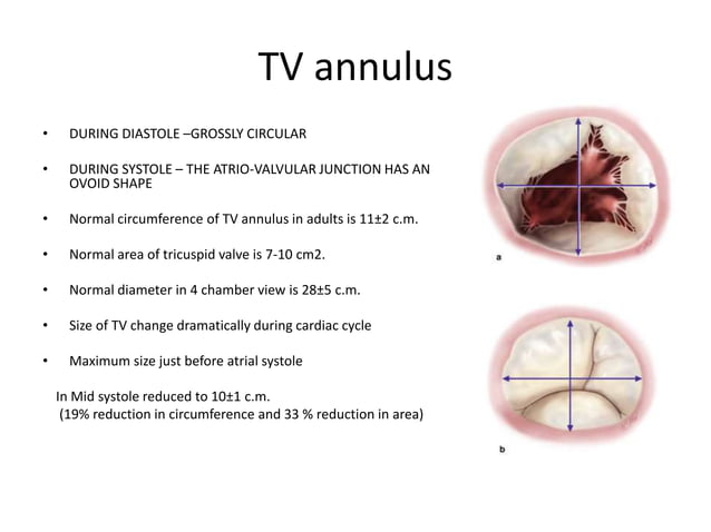 Normal anatomy of tricuspid valve | PPTX
