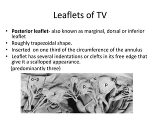 Normal anatomy of tricuspid valve | PPTX