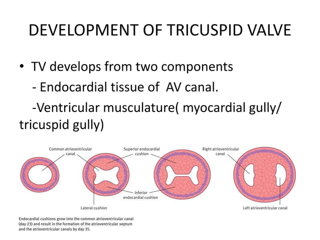 Normal anatomy of tricuspid valve | PPTX