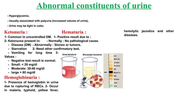 normal and abnormal constituents of urine.docx