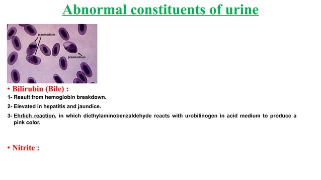 normal and abnormal constituents of urine.docx