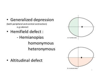 normal and abnormal field (1).pptx