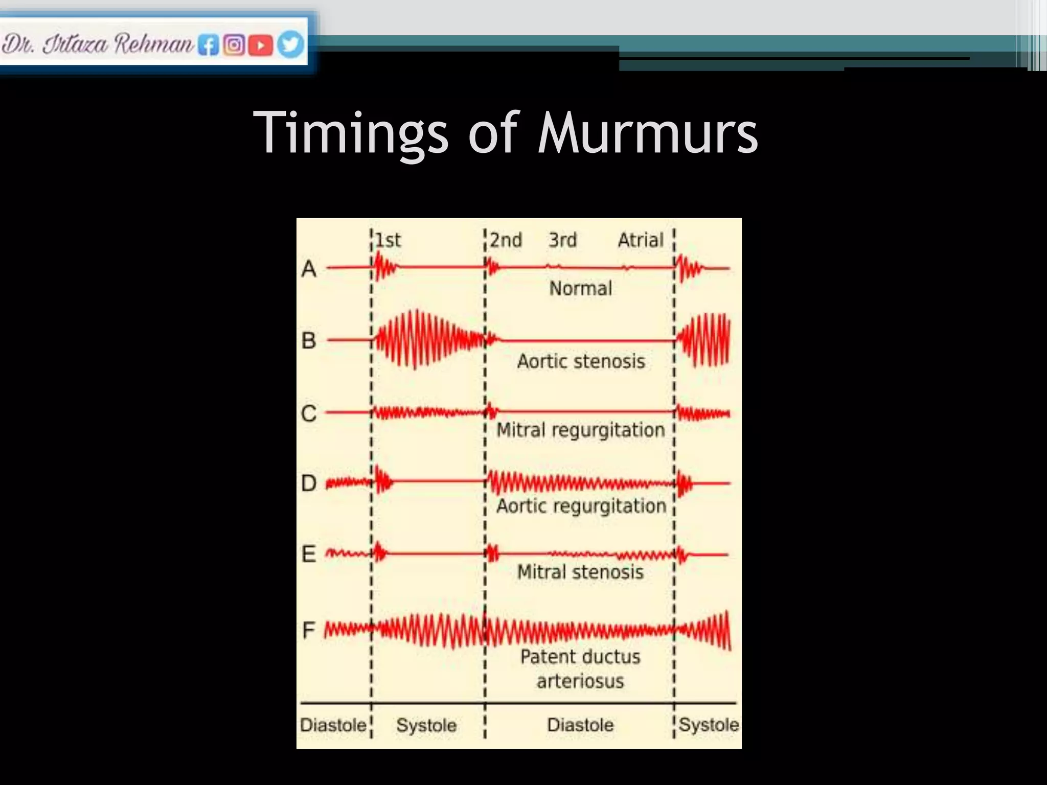 Normal and abnormal Heart sounds (Murmurs).pptx
