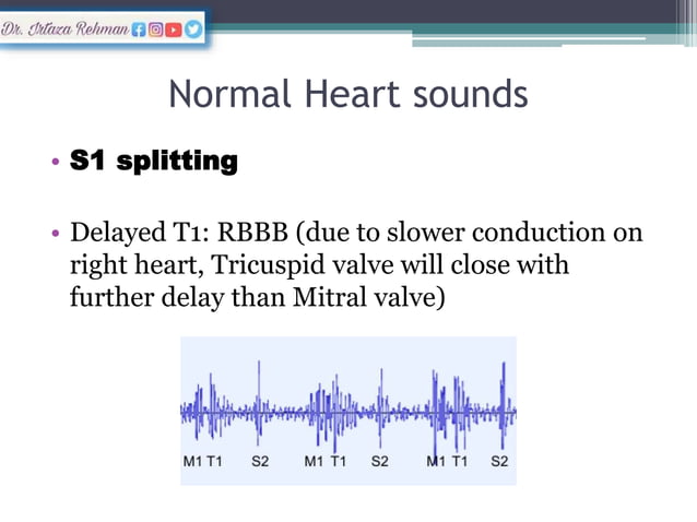 Normal and abnormal Heart sounds (Murmurs).pptx