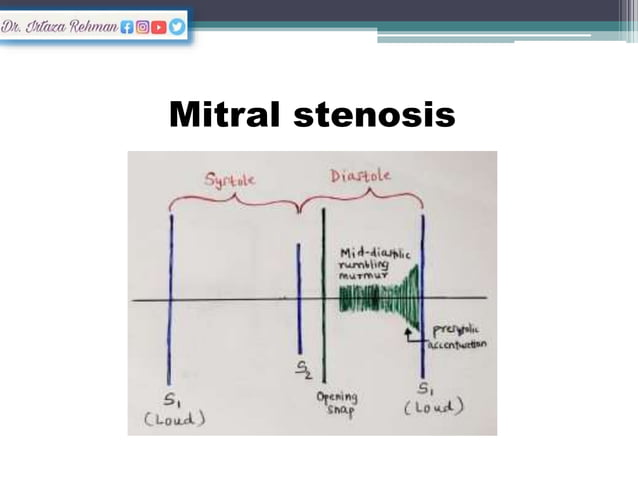 Normal and abnormal Heart sounds (Murmurs).pptx
