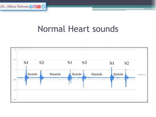 Normal and abnormal Heart sounds (Murmurs).pptx