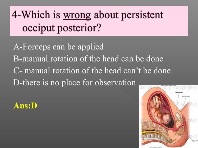 Normal and abnormal labor part 2 | PPT
