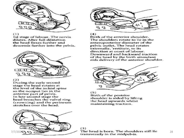 NORMAL AND ABNORMAL LABOUR.mmmmmmmmmmmmmpptx | PPT