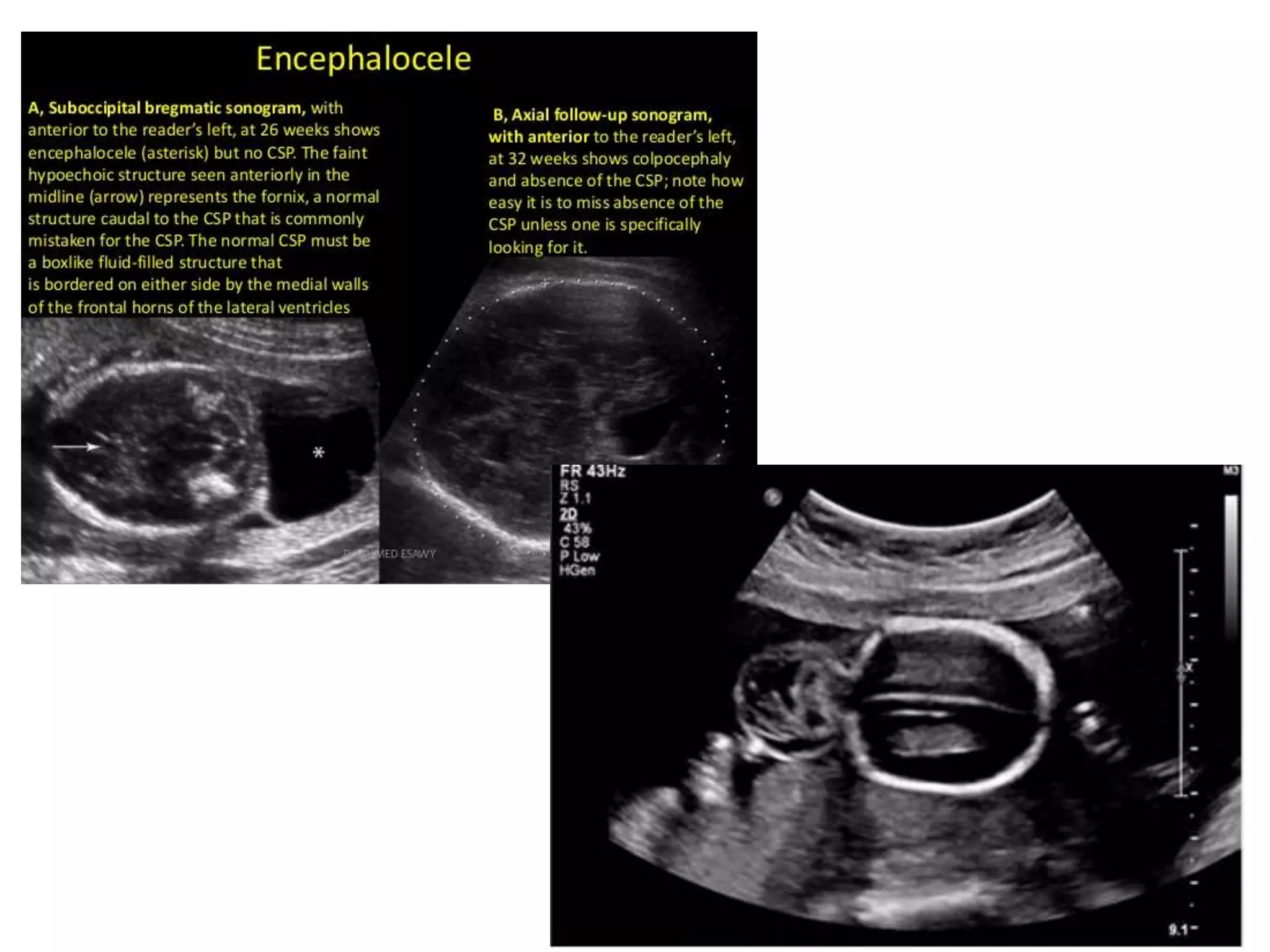 Normal and abnormal of Obstetric , Slidshare ppt.pptx