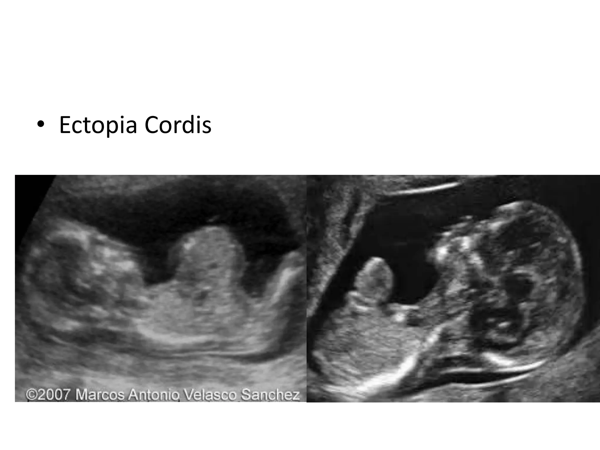 Normal and abnormal of Obstetric , Slidshare ppt.pptx