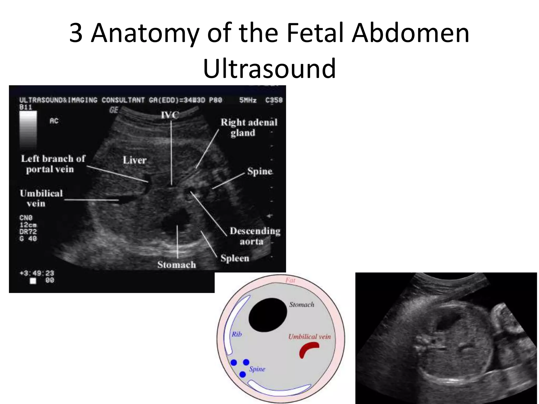 Normal and abnormal of Obstetric , Slidshare ppt.pptx