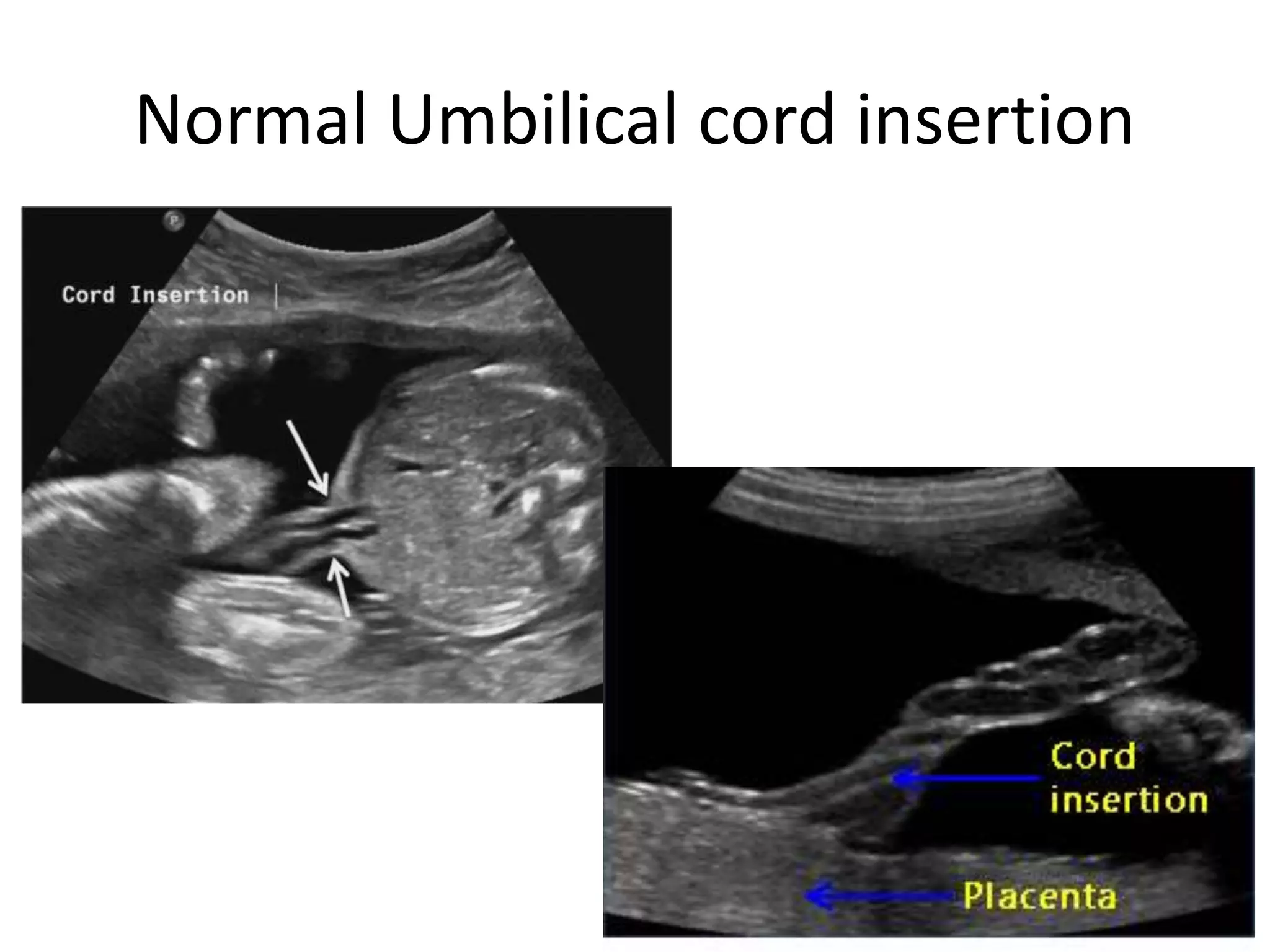 Normal and abnormal of Obstetric , Slidshare ppt.pptx