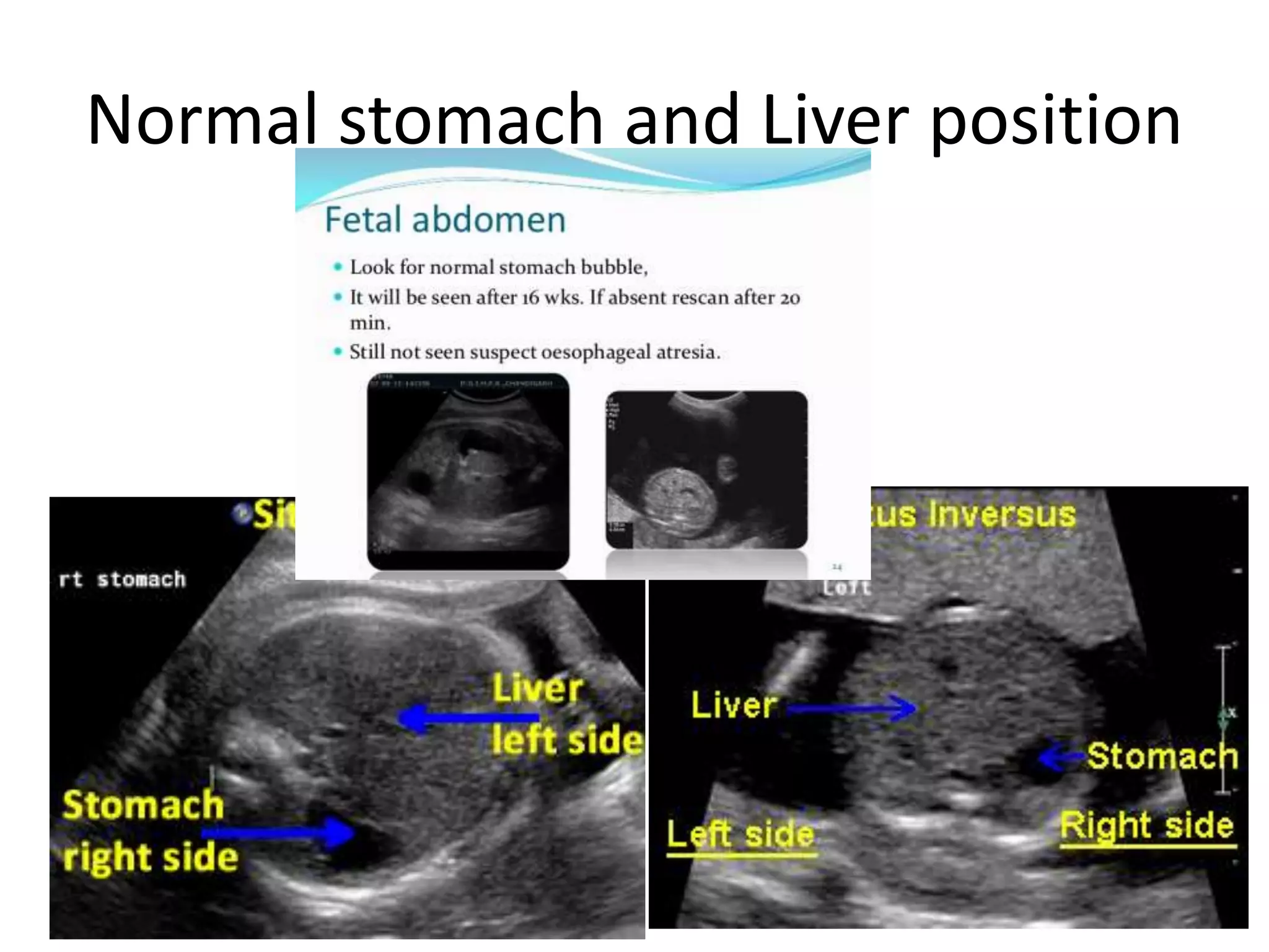 Normal and abnormal of Obstetric , Slidshare ppt.pptx