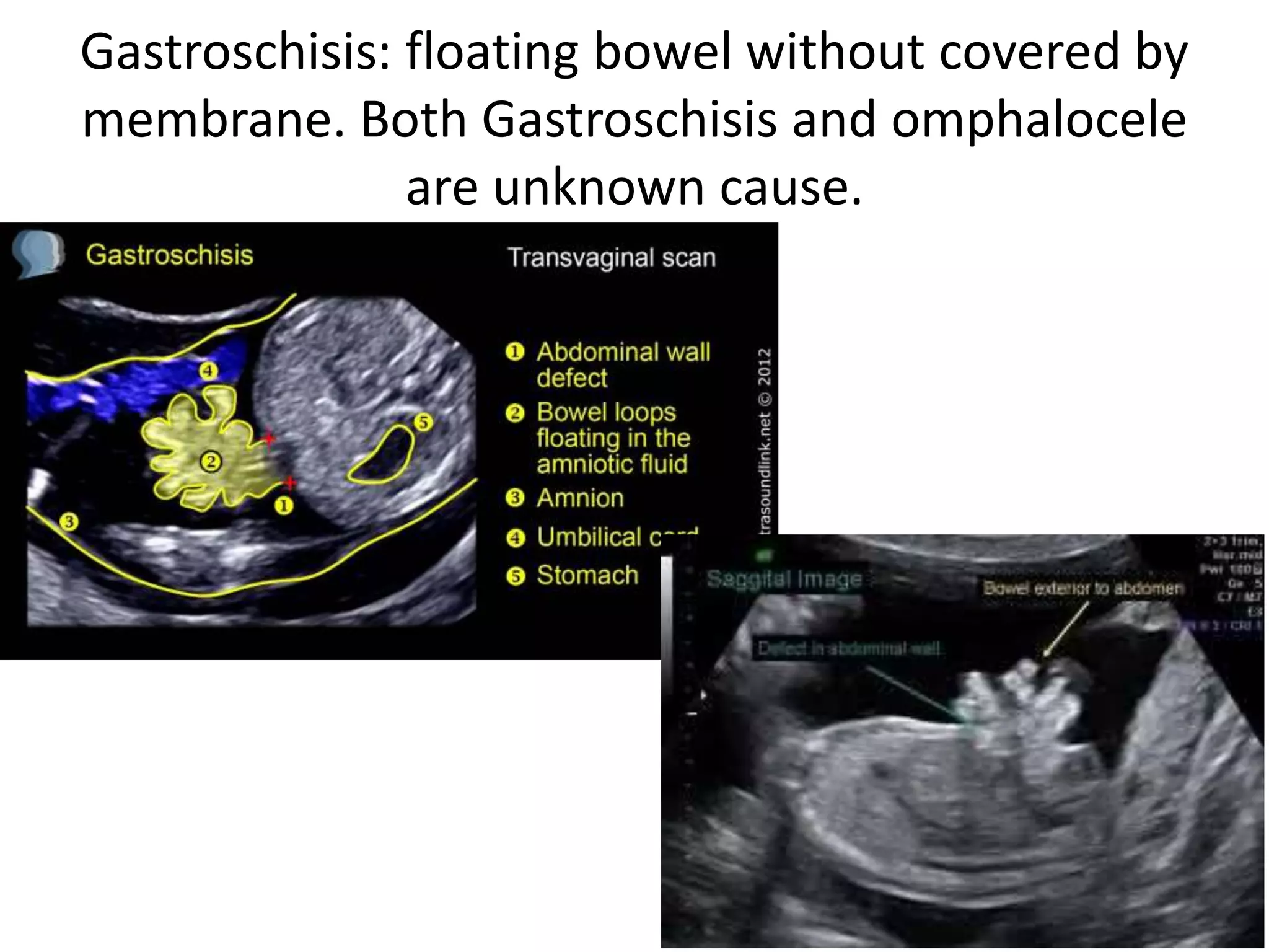 Normal and abnormal of Obstetric , Slidshare ppt.pptx