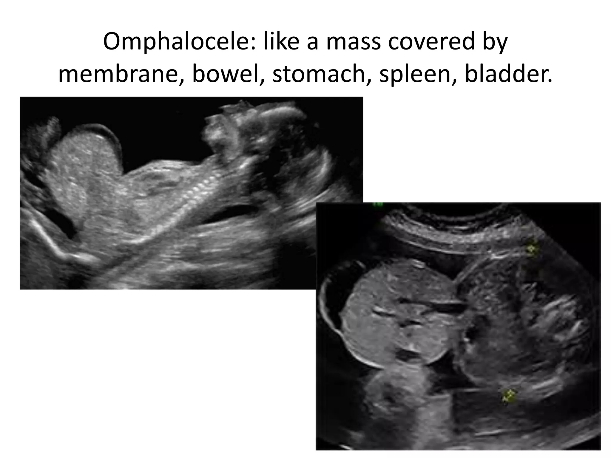 Normal and abnormal of Obstetric , Slidshare ppt.pptx