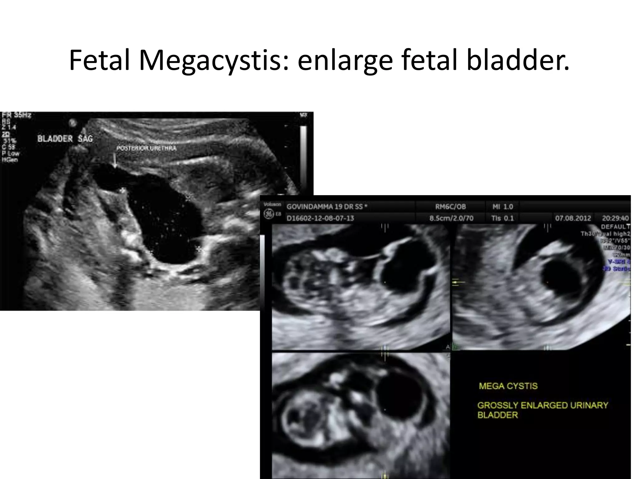 Normal and abnormal of Obstetric , Slidshare ppt.pptx