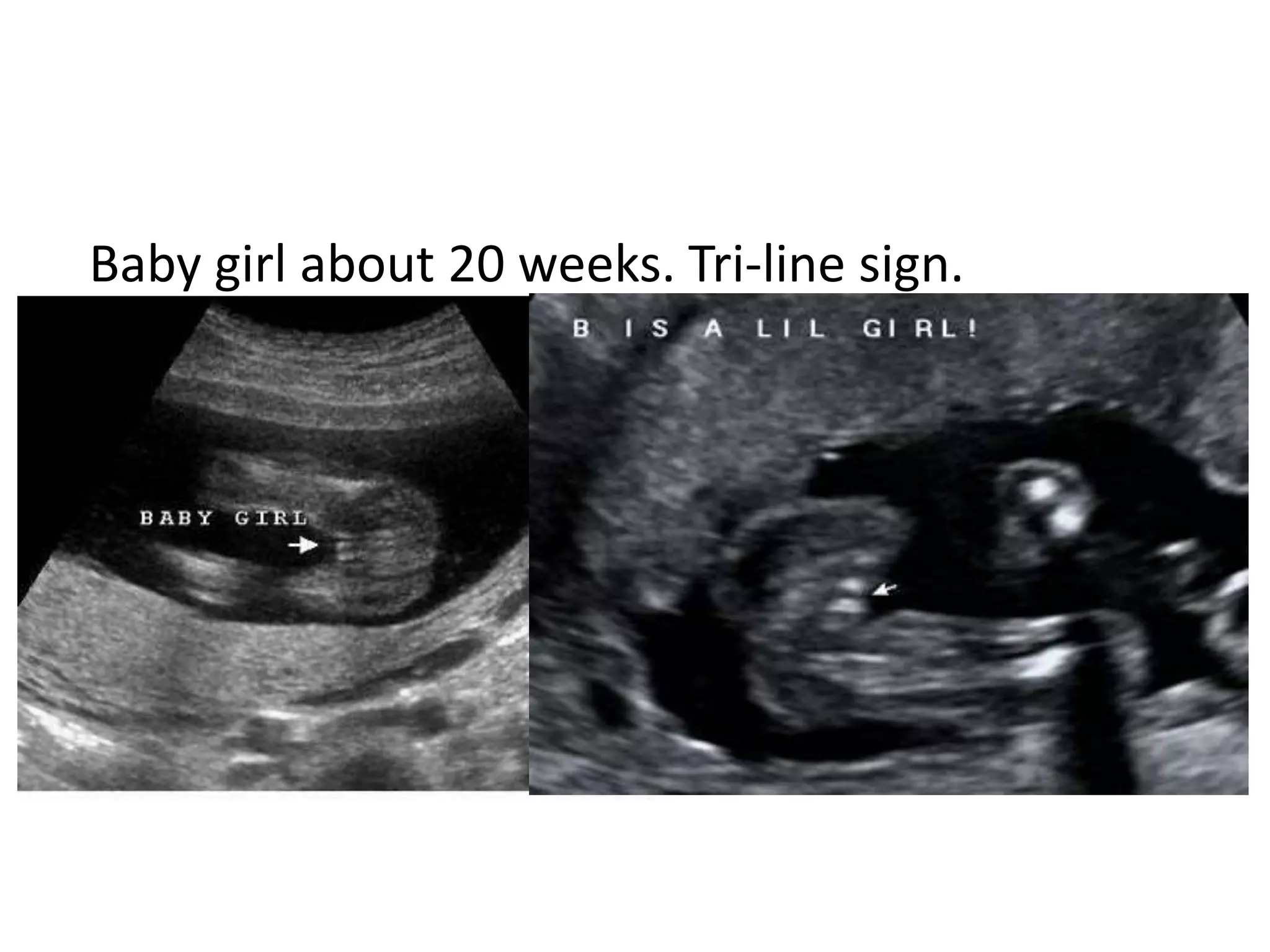 Normal and abnormal of Obstetric , Slidshare ppt.pptx