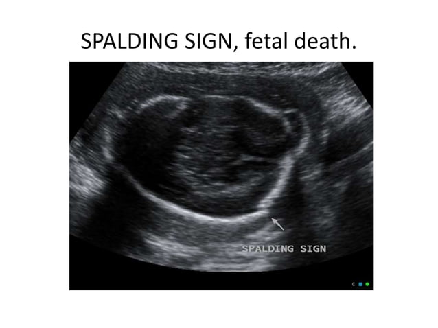 Normal and abnormal of Obstetric , Slidshare ppt.pptx